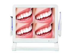 Tandheelkundige endoscoop met 17 inch monitor wifi draagbare tandheelkundige camera intraorale endoscoop intraorale camera