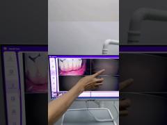 dental clinic dental trolley with pc and oral camera unique mobile dental unit with lamp