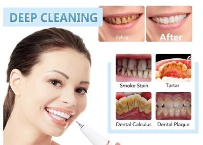 China tipo C de 2.1W 1A Sonic Brush Calculus Remover 37KHZ recarregável à venda