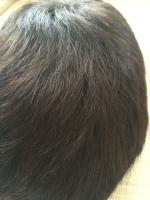 Quality Custom Hair Replacement Systems 12"-24" 100% Human Hair Toupee for sale