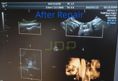 Китай GE RIC5-9-D Зонд SN:1870***** для ремонта продается