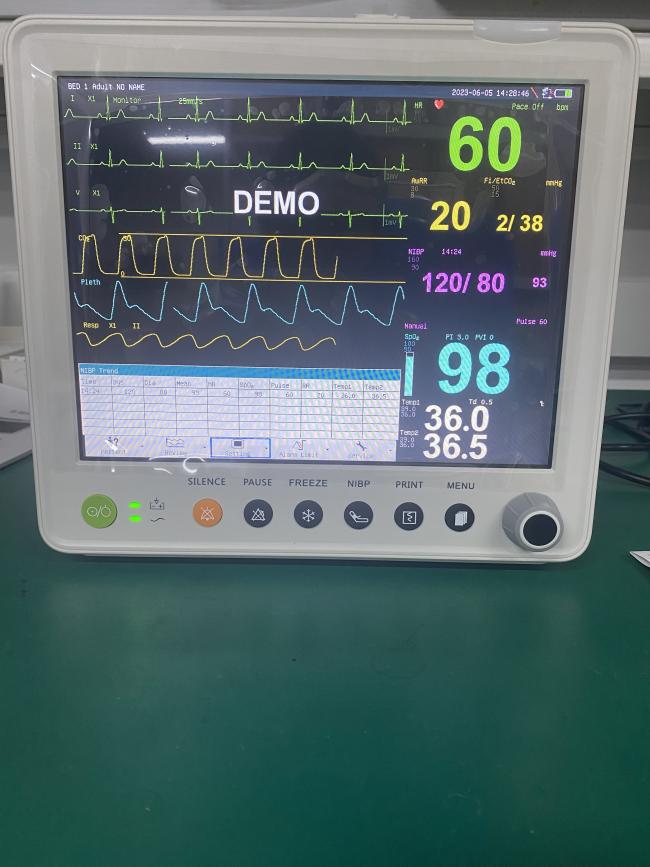 Patient monitor side view
