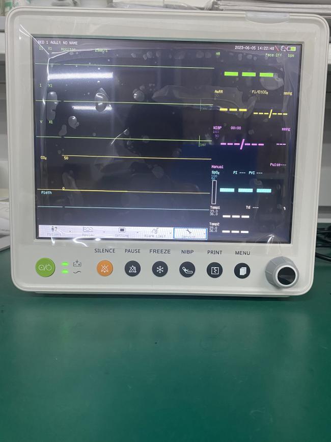 Monitor in clinical setting