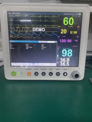 China Portable Veterinary ECG Machine with Battery/AC Power Supply for sale