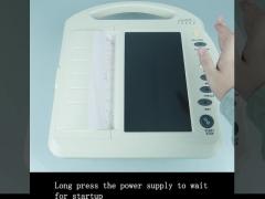 12 Draagbare Draadloze 12 Loodecg Machine van de kanaalpc Gebaseerde ECG Machine