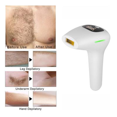Cina Colore bianco professionale di uso del laser della macchina tenuta in mano domestica di depilazione in vendita