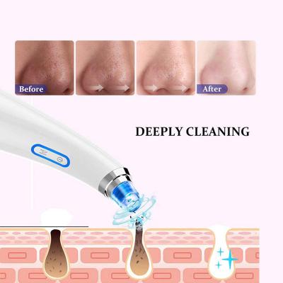 中国 Blackheadの除去剤の真空は、吸引の彼女の女性のための顔の皮の真空用具のBlackheadのバレンタイン デーのギフトを彼M詳細に調べる 販売のため