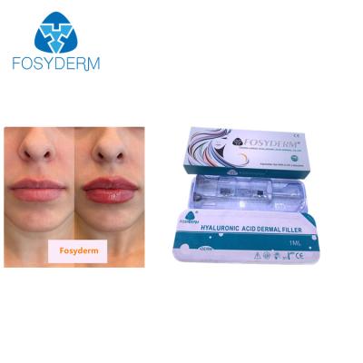 Китай Hyaluronic кисловочный заполнитель Fosyderm впрыски 1ml дермальный для губы продается