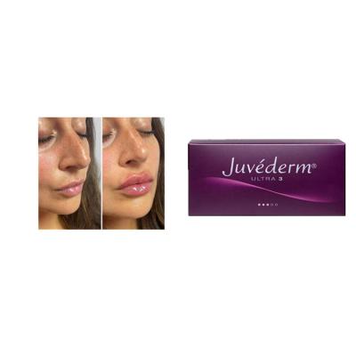 Chine Acide hyaluronique cutané de remplisseur lié par croix de Juvederm 24mg 2ml à vendre