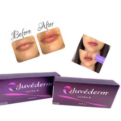 Китай Hyaluronic кисловочный дермальный Ce анти- старея 2ml заполнителя губы Juvederm впрыски геля продается