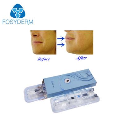 China Injectable Hyaluronic Acid Dermal Filler , 24mg Cross Linked Gel HA Injection for sale
