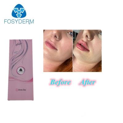 China 1ml 0.3% Lidocaine Lip Filler Hyaluronic Acid Injection for sale