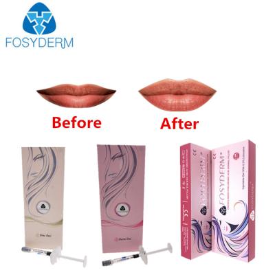 China Wrinkles And Lips Hyaluronic Acid Injectable Filler With Lidocaine for sale