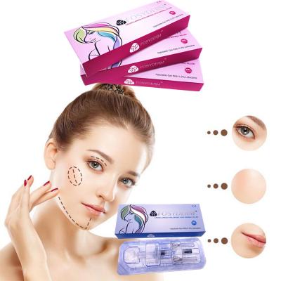 중국 CE 승인되 1 밀리람베르트 히알루론산 피부 필러 HA 주사 가능한 군턱 판매용