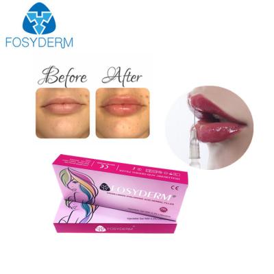 China 1ml hyaluronic zure Injectie van de de Lippenverhoging van Derm van lippenvullers voor Vrouwen for sale