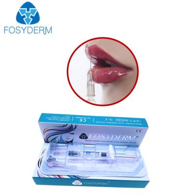 China 1.1ml Hyaluronic Acid Dermal Filler Lip Augmentation With Lidocaine for sale