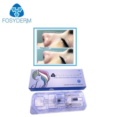 China 2 Ml Deep Line Hyaluronic Acid Dermal Filler Nose Up With Lidocaine for sale