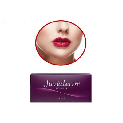 China Juvederm Ultra 3 Hyaluronic Acid Dermal Filler Russian Lips With Lidocaine for sale