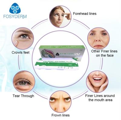 Cina il riempitore cutaneo iniettabile di 2ml Hyaluronate ha accetta l'OEM in vendita