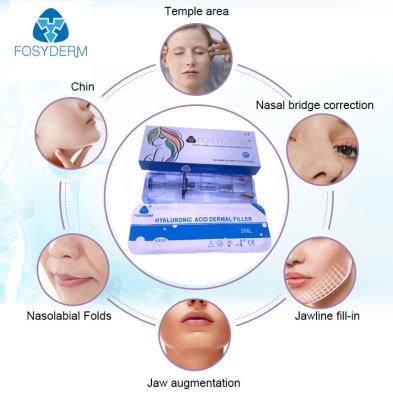 Cina il riempitore cutaneo iniettabile di 2ml Hyaluronate ha accetta l'OEM in vendita