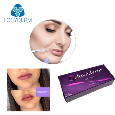 중국 Ultra3 Ultra4 볼우마 히알루론산 피부 필러 겔 주이더텀 Lip 충전기 24 마그네슘 / Ml 판매용