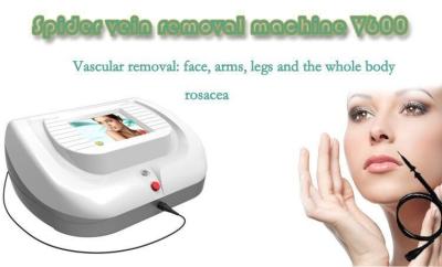 China 2016 Newest hot-sale high quality 30MHz  hospital blood vessels spider vein removal beauty machine for sale