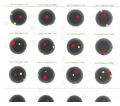 China Unicomp AX9100max Electronics X Ray Machine FOR Flip-Chip BGA (FCBGA) for sale