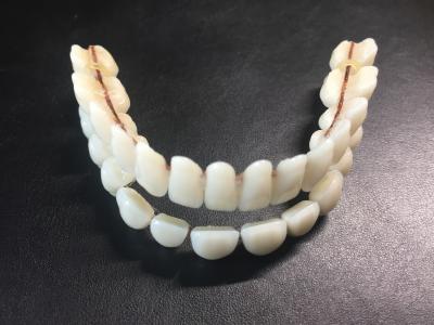 China Denture Repair Dental Acrylic Resin Teeth Kit Artificial Synthetic Resin Dentition Polymer for sale