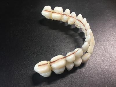 China Denture Repair Dental Acrylic Resin Teeth Kit Artificial Synthetic Resin Dentition Polymer for sale