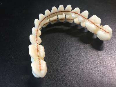 China Denture Repair Dental Acrylic Resin Teeth Kit Artificial Synthetic Resin Dentition Polymer for sale