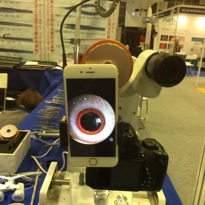 China Ophthalmic Colorful Universal Slit Lamp Smartphone Eyepiece Photography Video Adapter for ANY Slit Lamps for sale