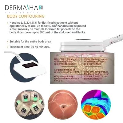 Cina 2MHz EMS Body Sculpting Machine Reduce Fat Hi-45P Trubody Fat Reduction RF Beauty Machine in vendita