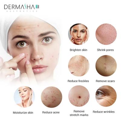 Cina H2 Face Skin Tightening Derma Pen Home Skin Rejuvenation Device Microneedling Pen Wireless in vendita