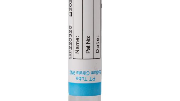 Quality Clinical Laboratory No Additive Blood Collection Tubes With Room Temperature Storage Efficiency for sale