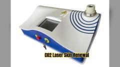 CO2 Laser Surgery Skin Resurfacing PC015 ES