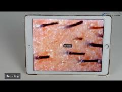 iPhone- en Android-microfoons