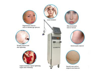 Cina Macchina frazionaria 10600nm del laser di Vaginal Tightening Co 2 stazionari in vendita