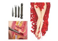 China Iso Rf Micro Acne Scars Co2 Fractional Laser Machine for sale