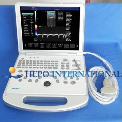 China 15inch monitor portable ultrasound scanner digital color doppler medical equipment for sale