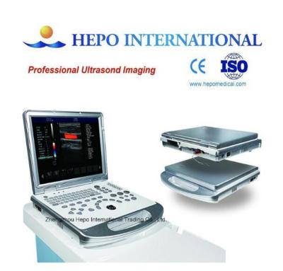 China Portable 3D/4D color doppler 15