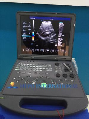 China Economic type portable color doppler 15