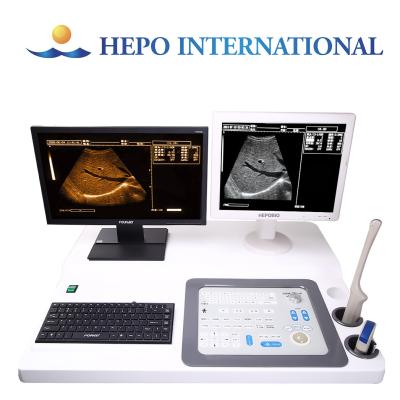 China 14 inch monitor medical device digital ultrasound system with workstation for sale