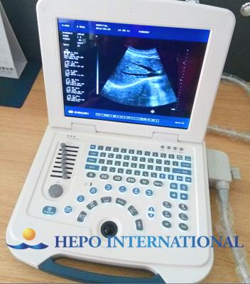 China diagnosis equipment portable 2D 12 inch monitor ultrasound scanner for medical for sale