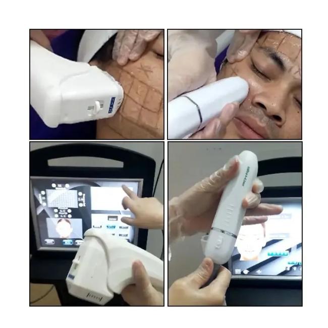 Portable 4D Hifu Facelift Vaginal Tightening Vmax Slimming Beauty Salon Machine 12 Lines 20000 Shots