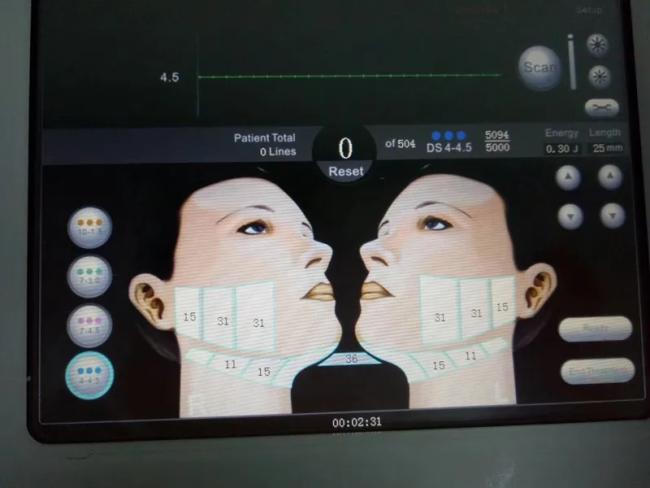 Mini HiFU Portable High Intensity Focused Ultrasound Ultrasonic face lifting wrinkle removal machine HIFU body slimming equipment4681806