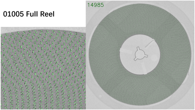 Sample X-ray component image 1