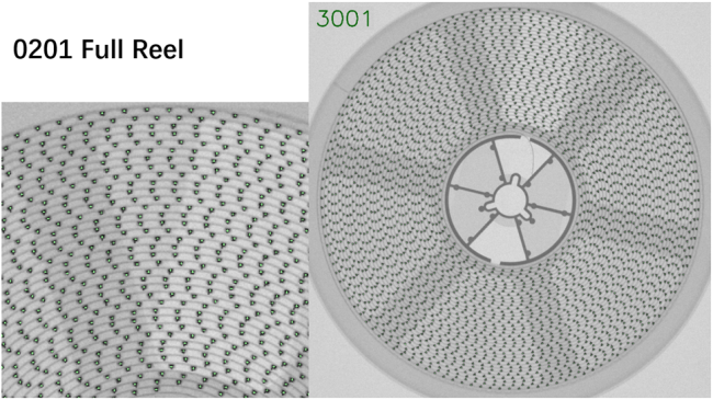 Sample X-ray component image 2