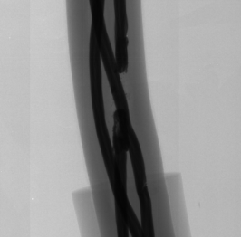 Cable inspection sample