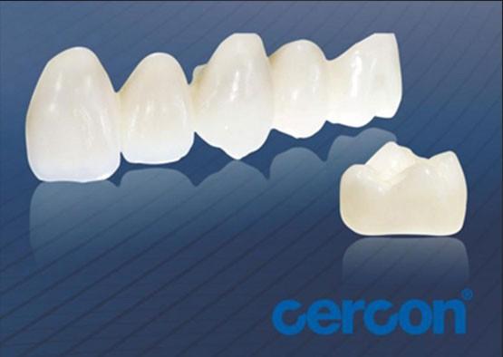 Cercon Zirconia