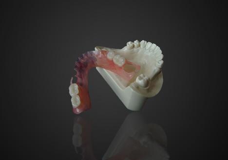  Valplast denture